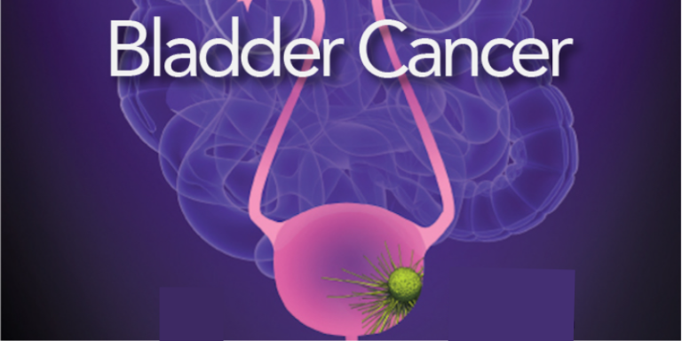 Understanding Bladder Cancer: Risk Factors- Symptoms and Treatment ...